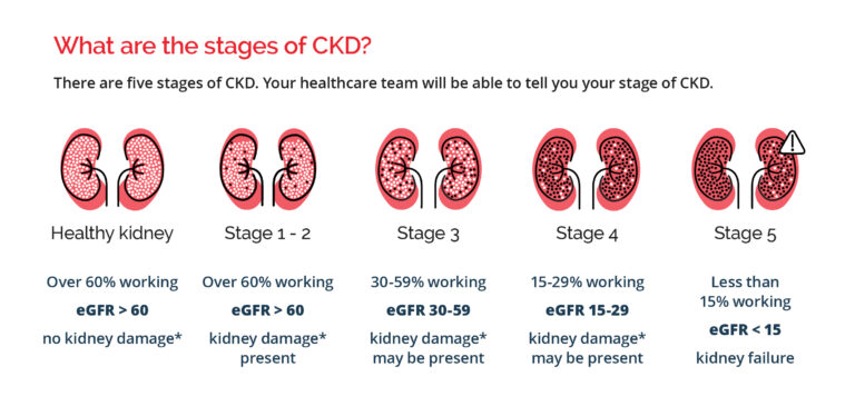 eGFR and stages of CKD | Kidney Health 4 Life